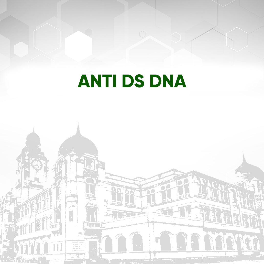 Anti Ds DNA – KMC Labs